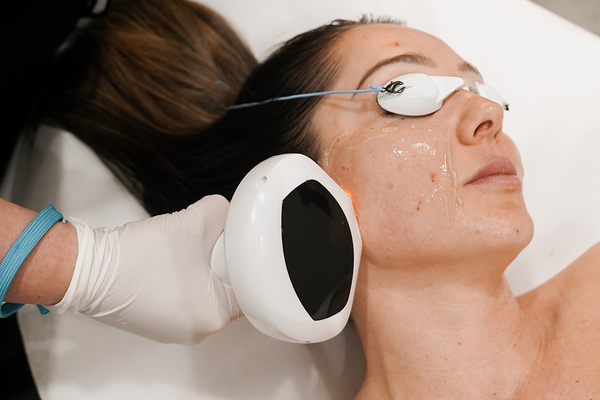 Lumecca IPL Melbourne (Non-Invasive) – The Derm Loft